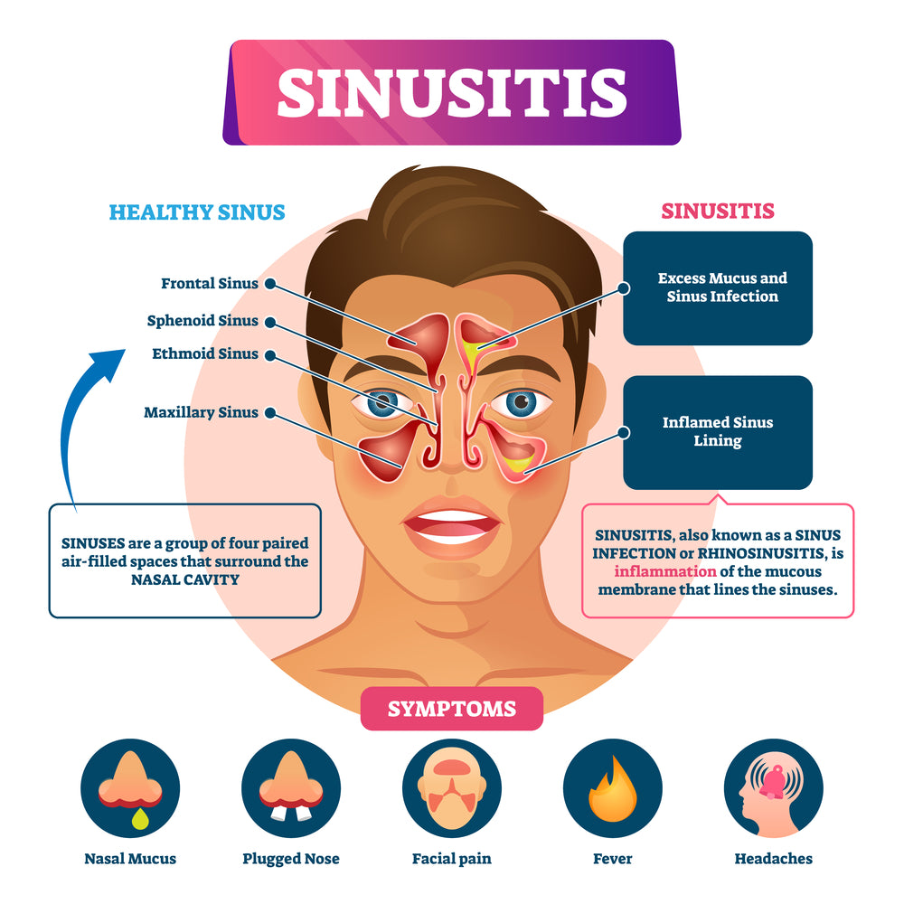 Sinus Flooding Kit | MesoSilver | Colloidal Minerals | Colloids for ...